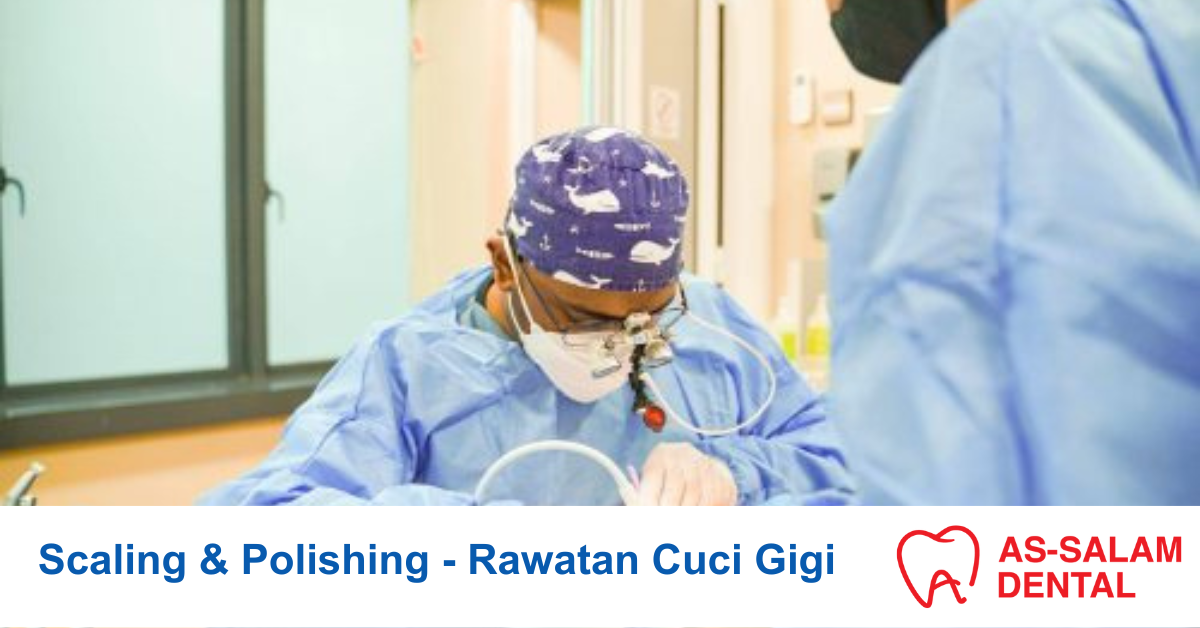 Rawatan Cuci Gigi Terbaik - Scaling & Polishing